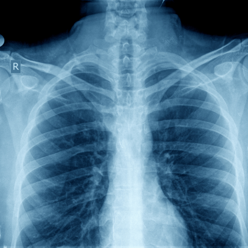 Tele de Tórax - Diagnóstico de las Américas Tele de Tórax